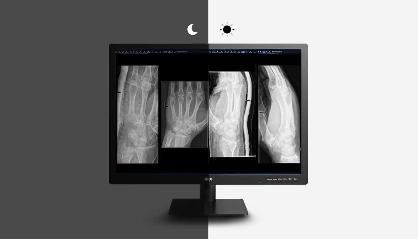 Why Medical Diagnostic Display? | Trucell